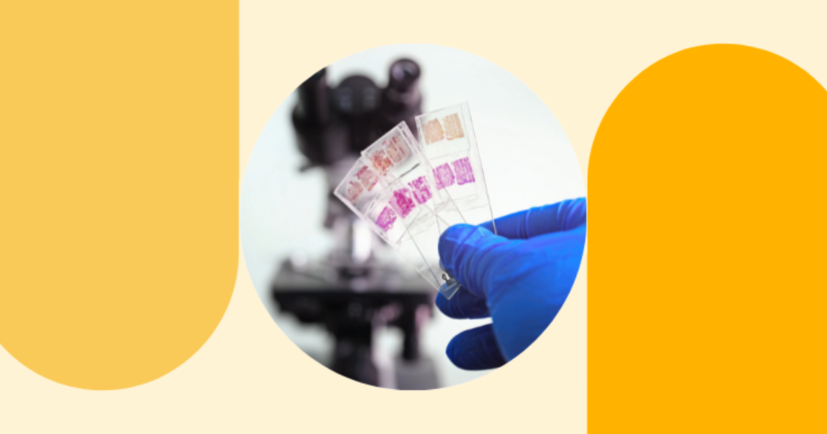 Pathology whole slide images for multimodal cancer… | Genomics England